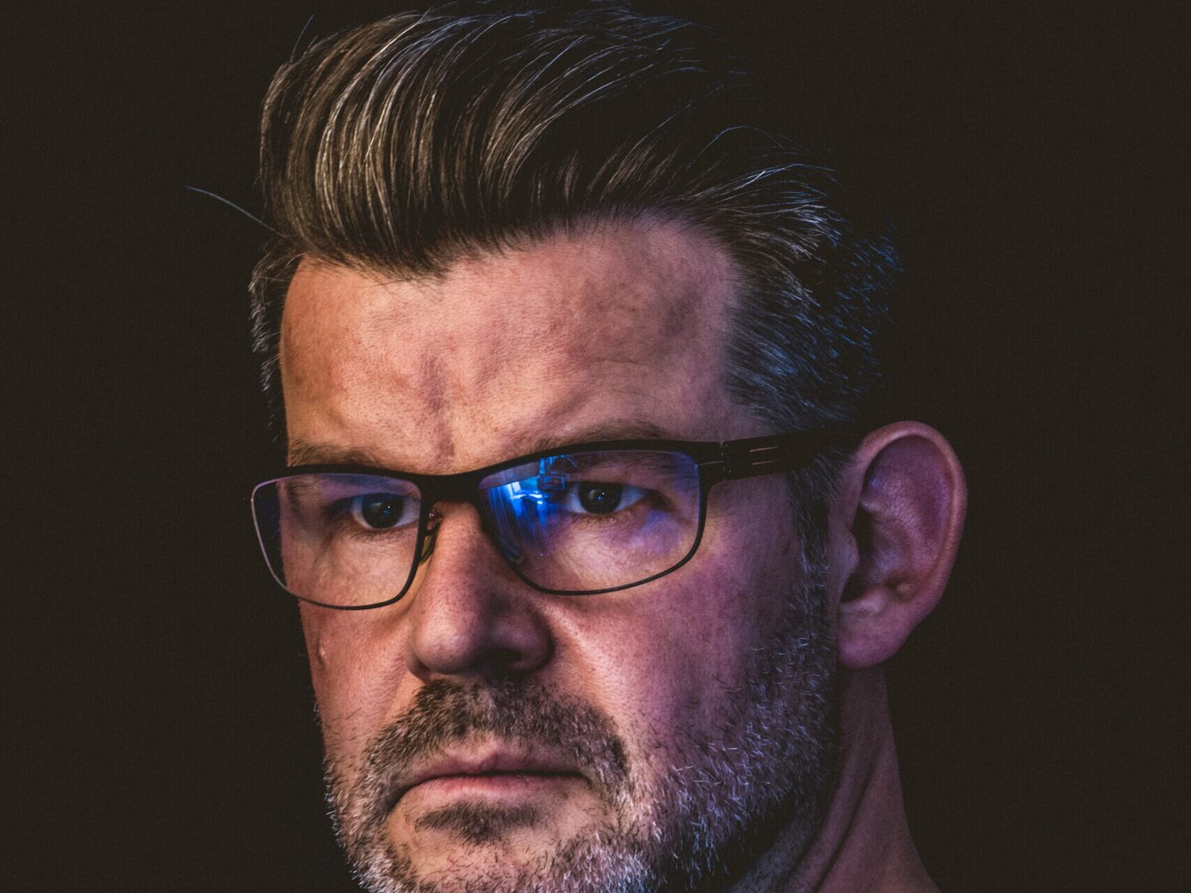Hair Transplants On Scars: Can They Be Performed On Men?